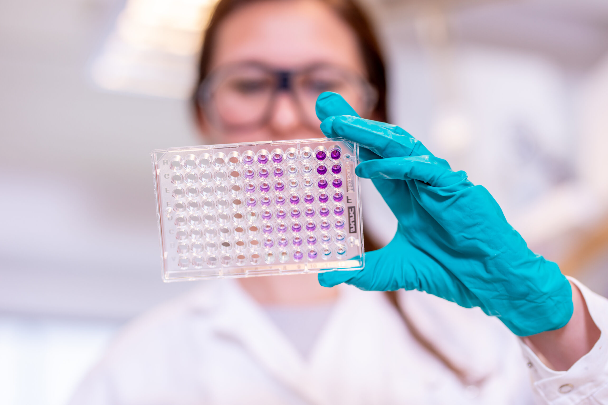 Badanie SOLO-1: Olaparyb wydłuża medianę czasu przeżycia do ponad 4,5 ...