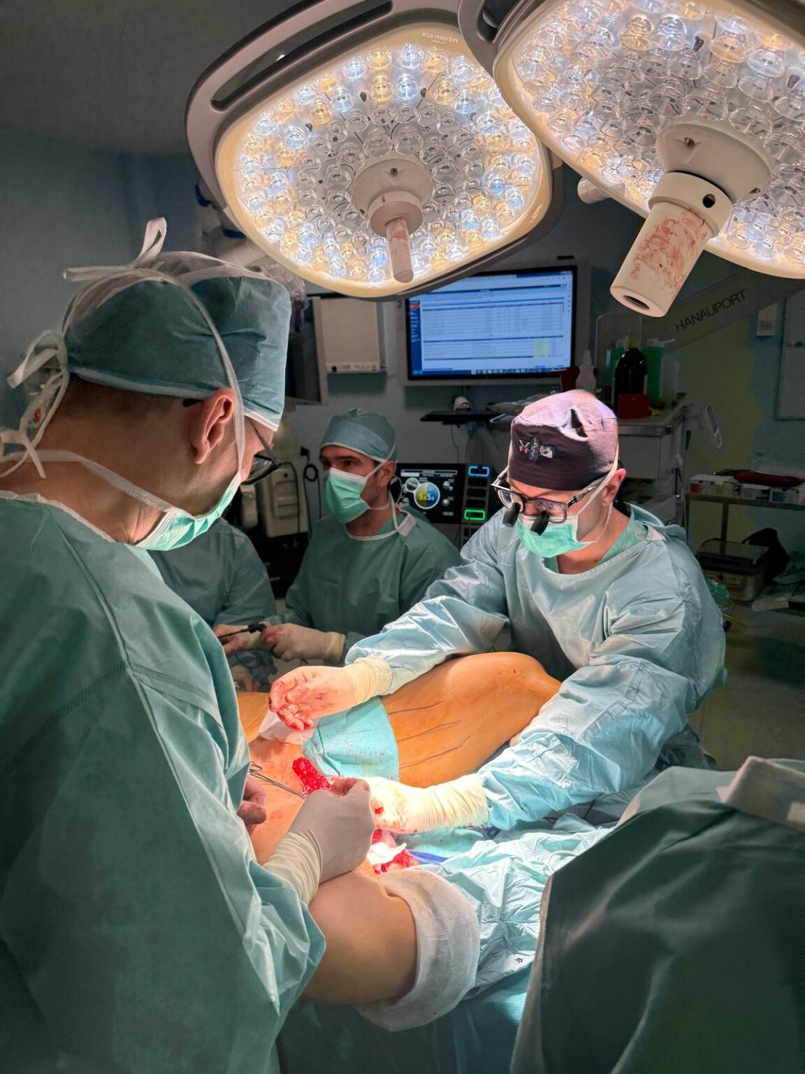 Pierwsza w Polsce endoskopowa mastektomia z rekonstrukcją PAP Flap ...